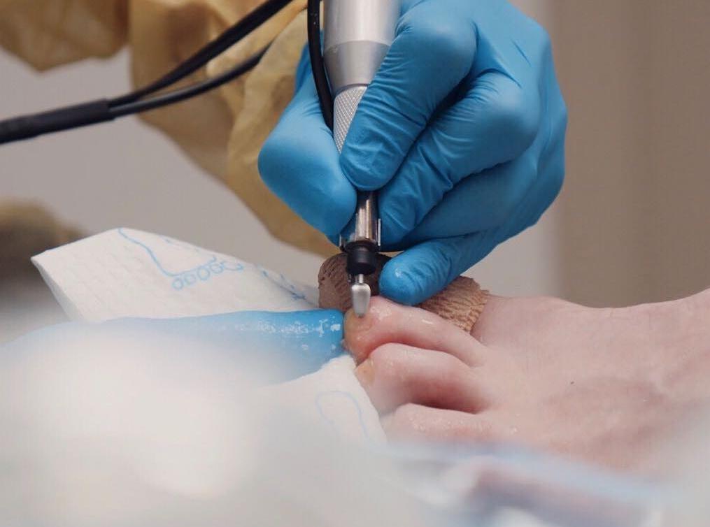 Where is "The Toe Bro" Located? We've Got Details on A&E's New Show