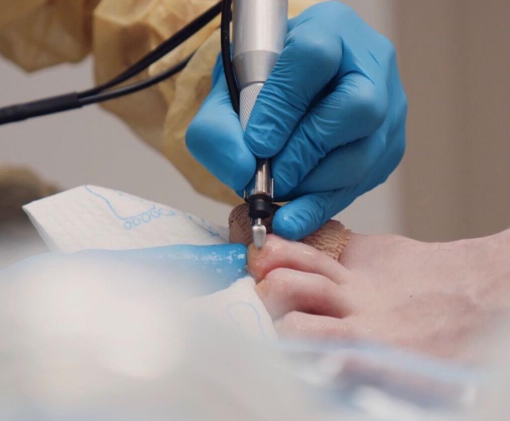 Where is "The Toe Bro" Located? We've Got Details on A&E's New Show