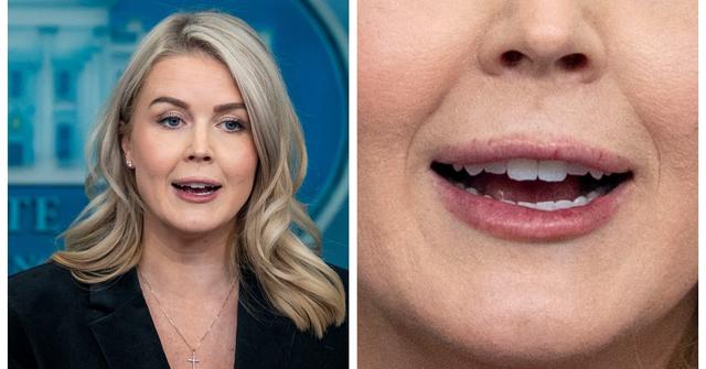 It's Hard to Miss Karoline Leavitt's Lip Filler in Vanity Fair